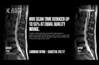 MROpenEVO – The best MRI experience